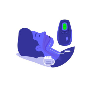 Inspire Sleep Apnea Review: Uncovering the Truth About This Treatment ...